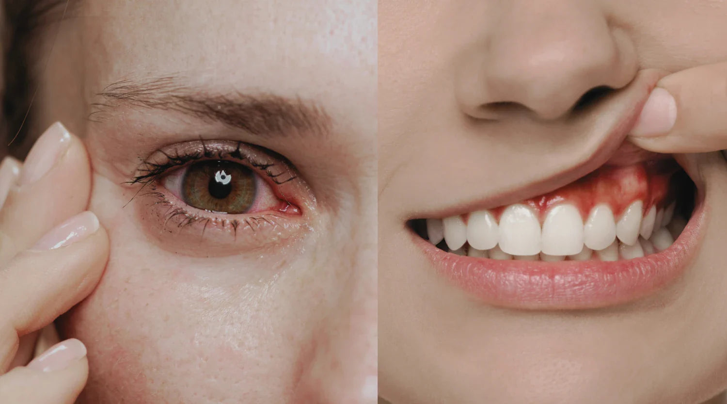 The Hidden Threat to Your Vision: Your Gums
